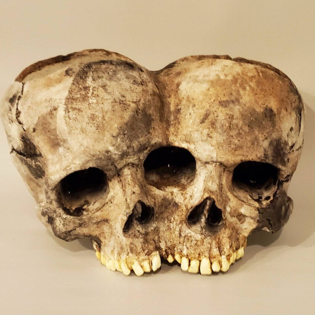 Conjoined Twins Human Skull Sculpture or Planter – ModernOnlineMart